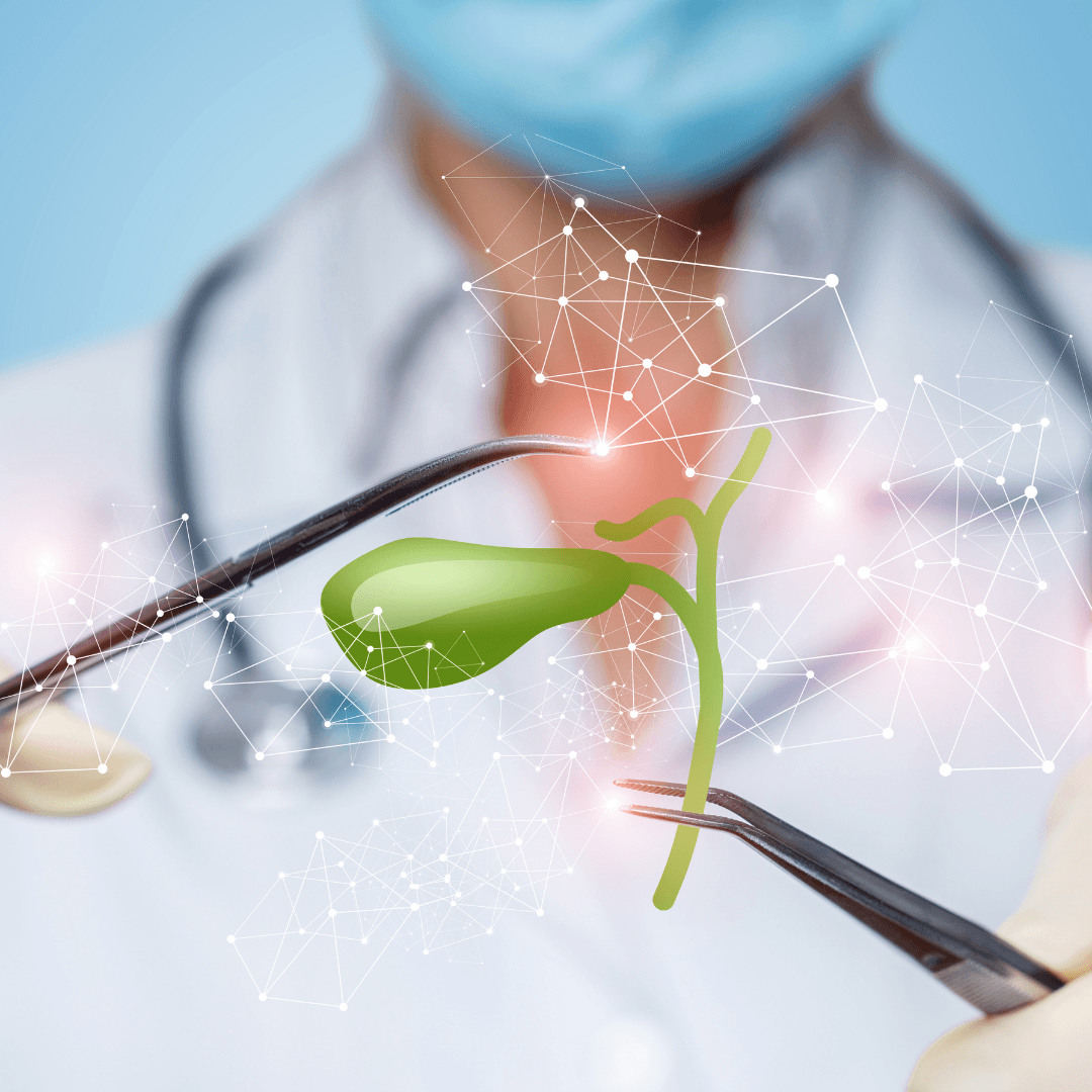 Thriving Without a Gallbladder: A Comprehensive Guide | Ulta Lab Tests